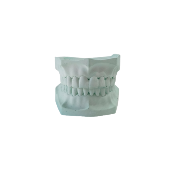 MODELO DE YESO DENTADO – Dento